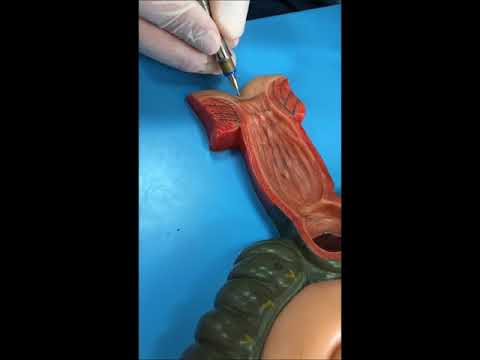 bağırsaklar rektum karın ön duvarı çıkmazlar