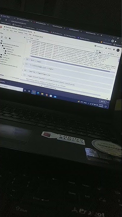 Retinal Disease Classification project #pyttsx3 #python - YouTube
