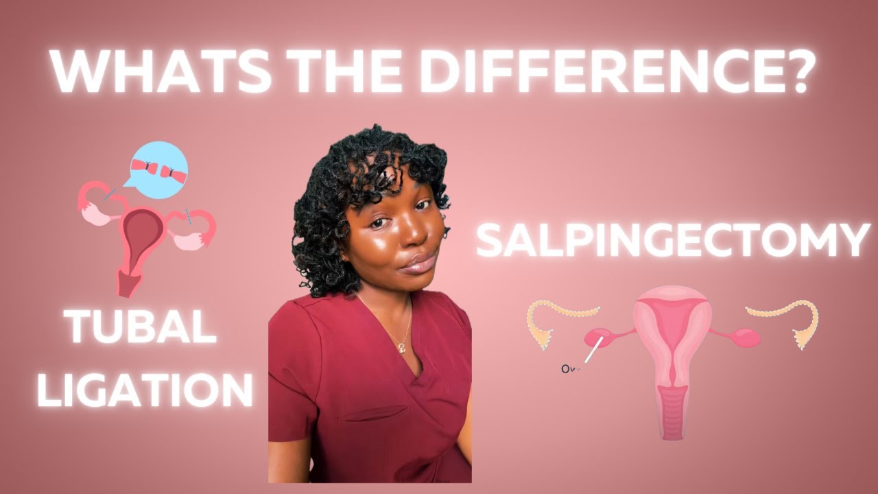 Tubal Ligation vs Salpingectomy - What’s the difference? - YouTube