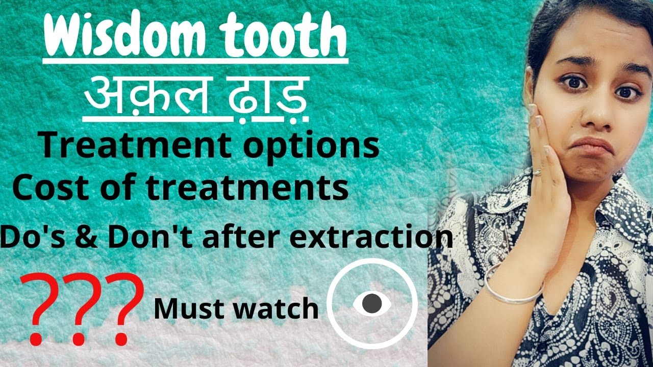 Treatment Of Wisdom Teeth | Akal Daant Ka Ilaaj | Do's & Don't After ...