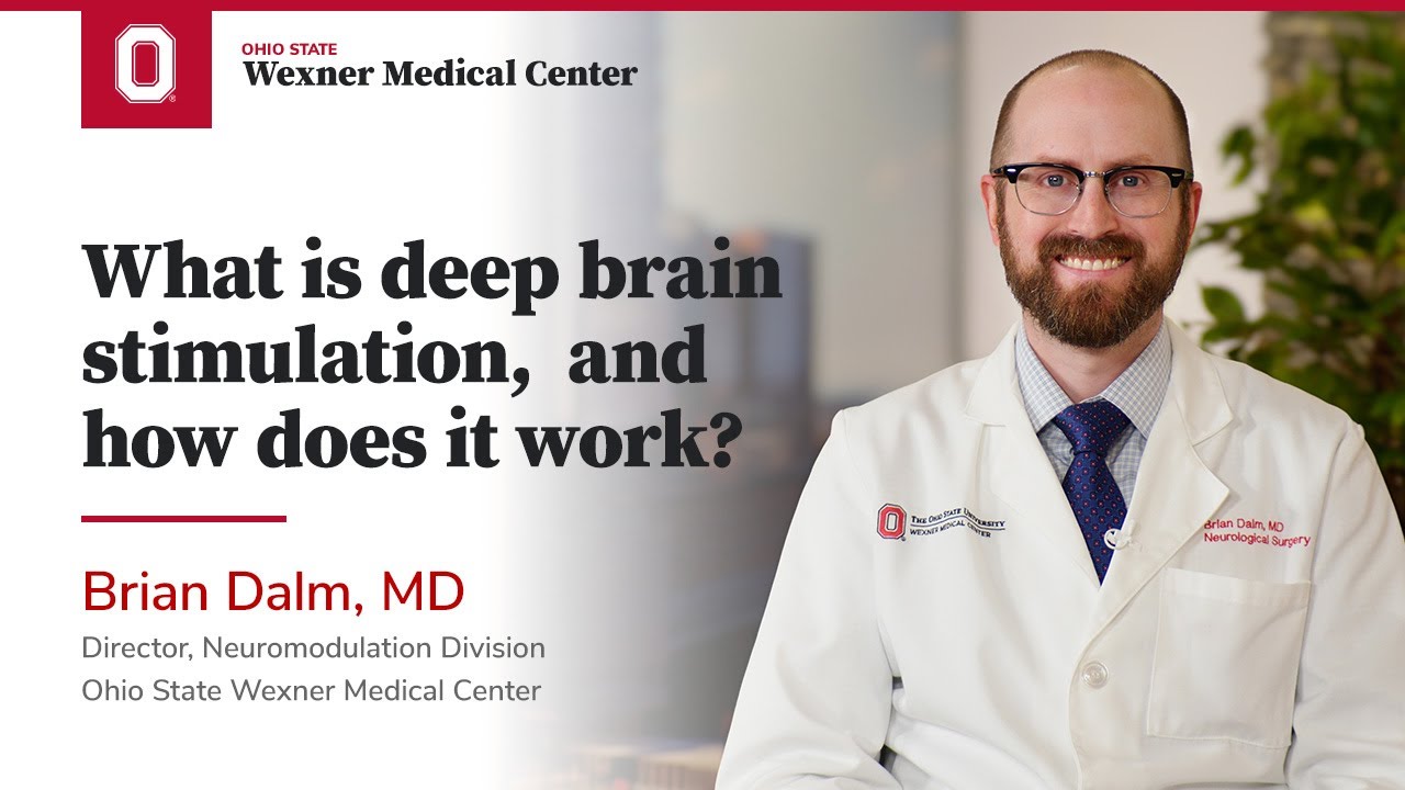 What is deep brain stimulation, and how does it work? | Ohio State ...