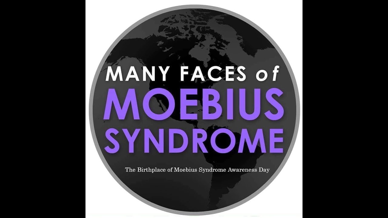 What is Moebius Syndrome? - YouTube