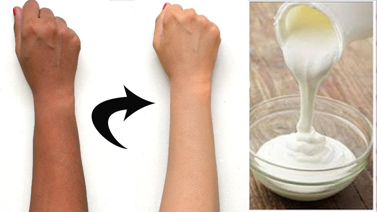 கைகளில் உள்ள கருமை போக்க தீர்வு | Hand Tan Whitening Naturally At Home ...