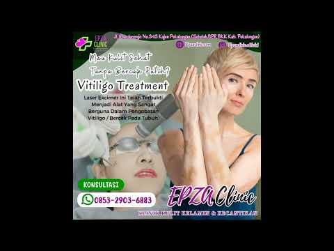 PENGOBATAN Bercak Putih Pada Kulit Paha Hubungi Telp/WA 0853-2903-6883 Di Epza Clinic Kendal