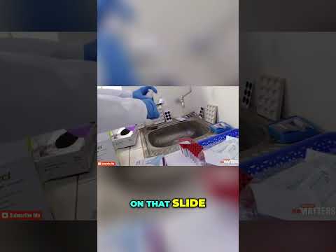 How to Fix Your Smear: Essential Tips for Weight Loss - YouTube