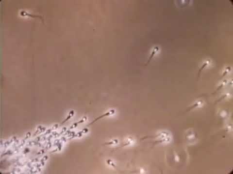 Spermatozo des Humain Observ s Au Microscope Optique YouTube spermatozo-des-humain-observ-s-au-microscope-optique-youtube