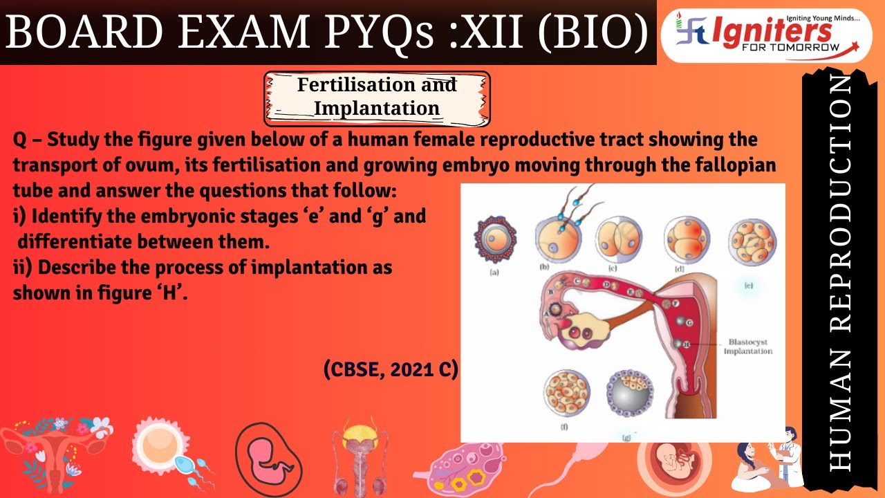 Study the figure given below of a human female reproductive tract ...