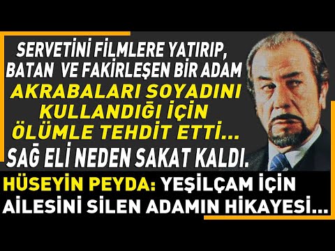 Hüseyin Peyda: Sinema yüzünden bir gözü kör olur, sağ eli sakat kalır.