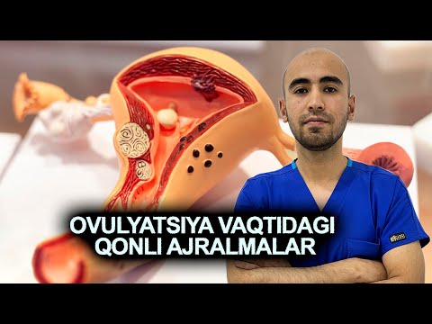 ovulyatsiya vaqtidagi qonli ajralmalar