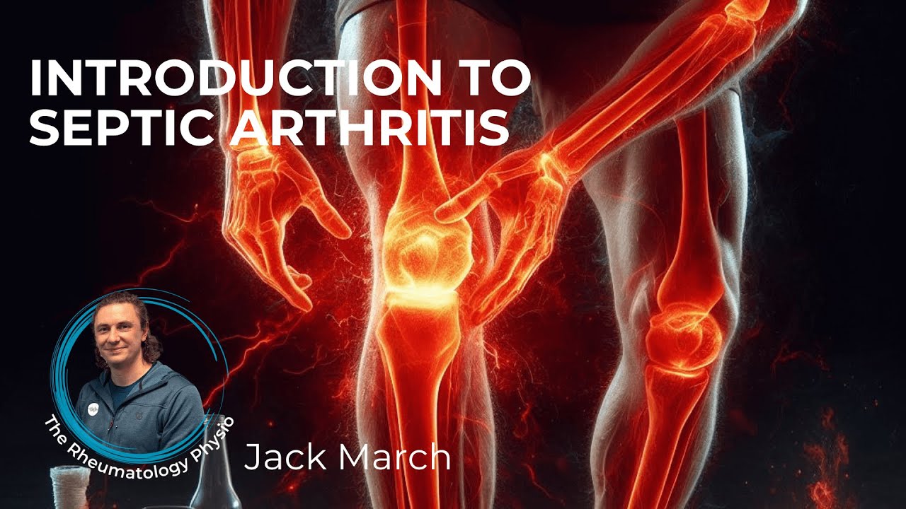Septic Arthritis Explained – Causes, Symptoms & Treatment | 35-Minute ...