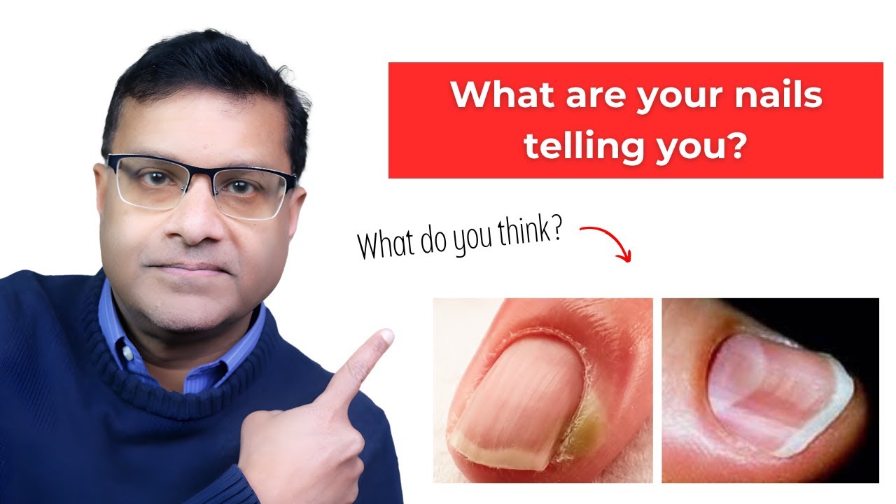 11 Warning Signs on Your Nails: What Do They Really Mean? - YouTube
