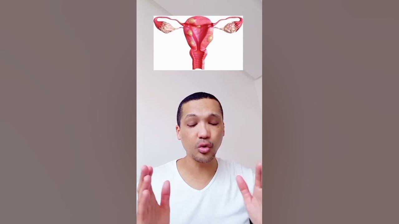 الاورام الليفية الرحمية Uterine Fibroids Drsaadmaelainin Doctor Health الدكتورماءالعينين