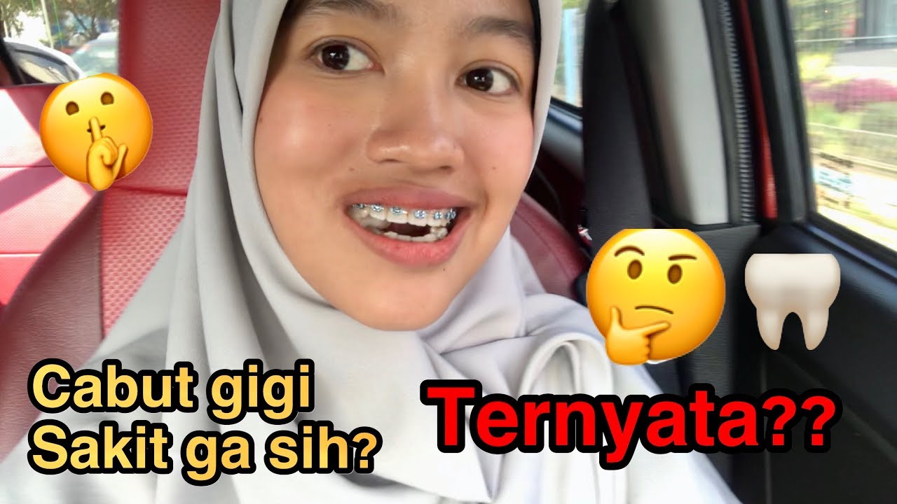 Pengalaman cabut gigi sakit atau ngga? TERNYATA... TIDAK SAKIT - YouTube