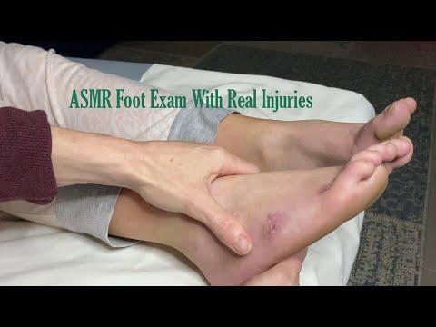 ASMR Foot Exam With Real Injuries - YouTube