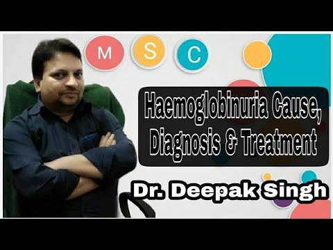 Haemoglobinuria Cause, Diagnosis And Treatment # Free Hb in Urine # Dr ...