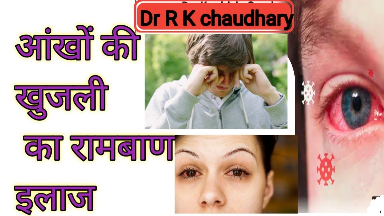 Olopatadine eye drops।olopatadine eye drops hindi।आंखो एलर्जी की के ...