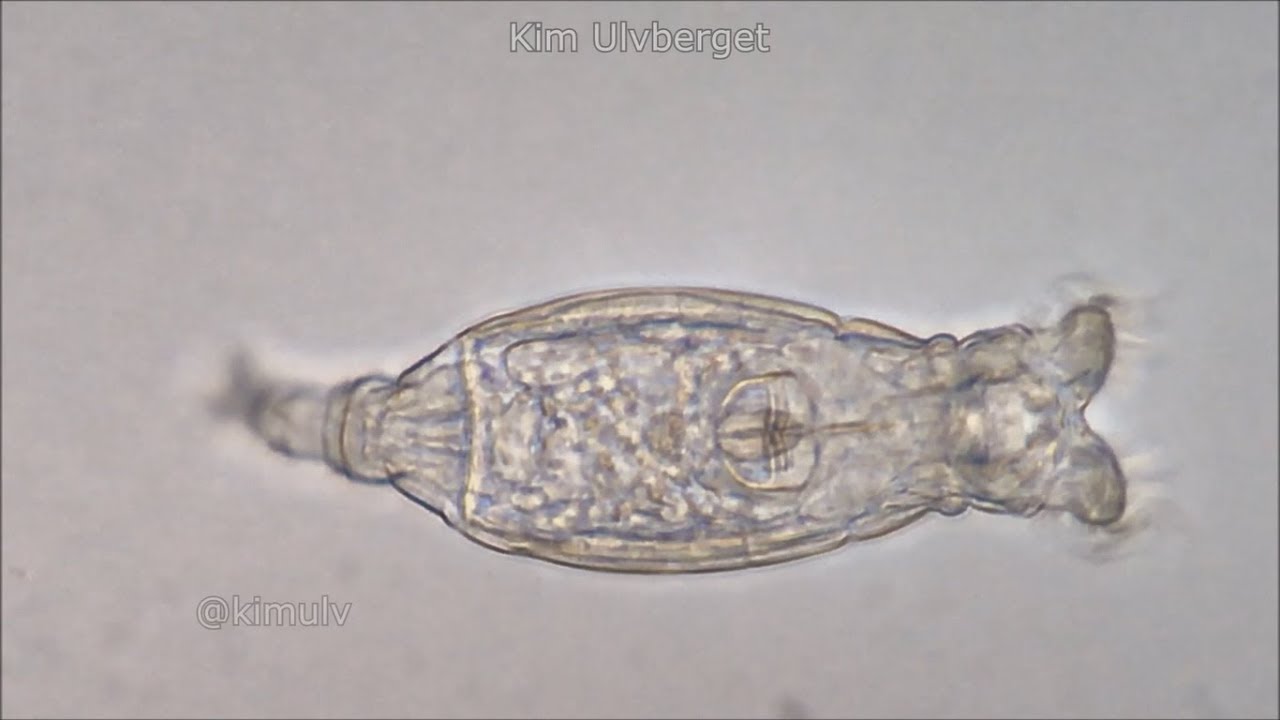 Rotifer Showing It's Cilia Crown - Rotifer Under a Microscope - YouTube