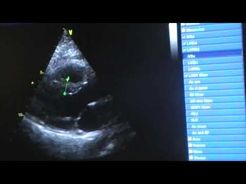 Complete echo protocol - YouTube