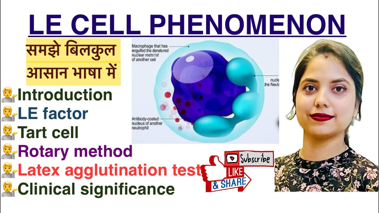 LE cell Phenomenon in Hindi | SLE | LE factor | Tart Cell | Latex ...