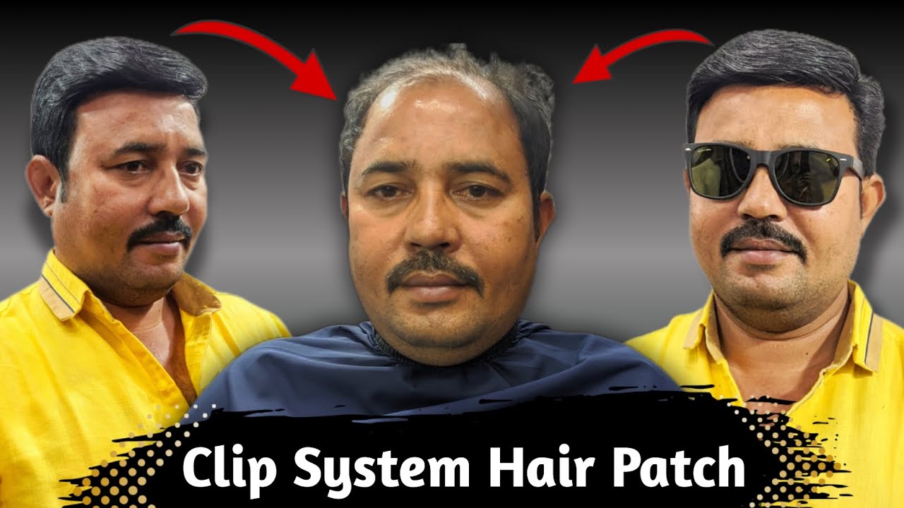 Clip System Hair Patch | Hair Clip System Review | Clip on Hair Patch ...