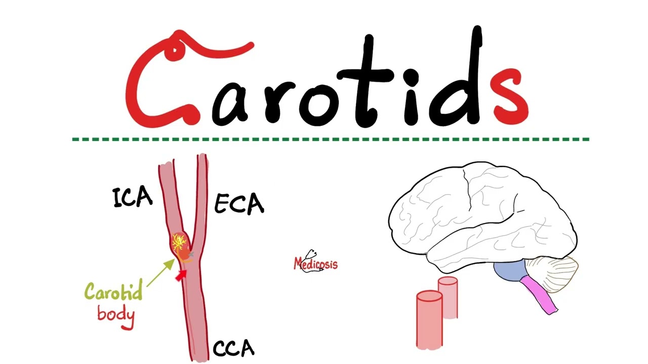 Internal Carotid Artries