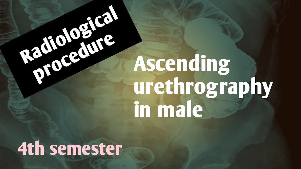 #Ascending urethrography in male/indications/technique/Procedure ...