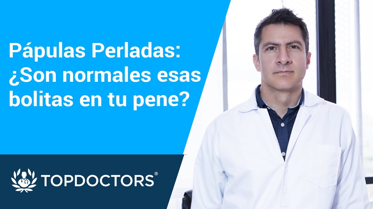 Pápulas perladas: ¿Son normales esas bolitas en tu pene? - YouTube