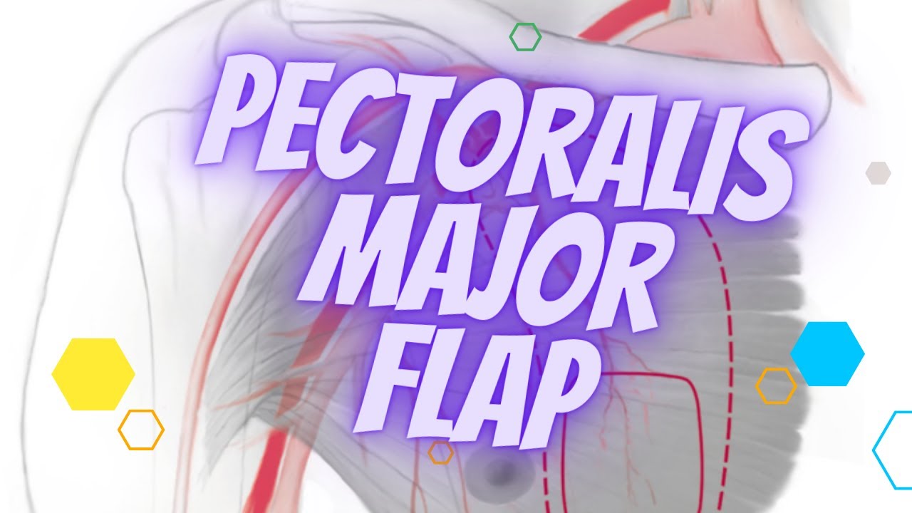 PECTORALIS MAJOR MYOCUTANOUS FLAP FOR ORAL RECONSTRUCTION - YouTube