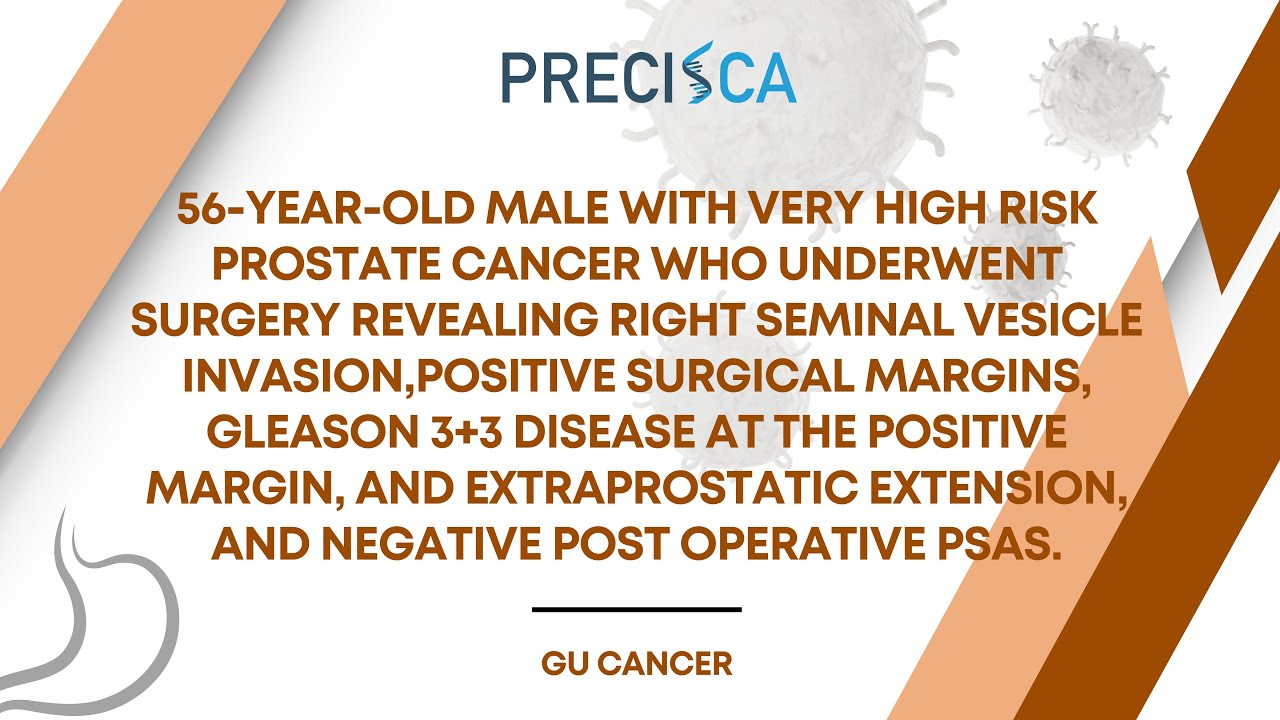 Expert Cancer Panel: High-risk prostate ca w/ positive margin at ...