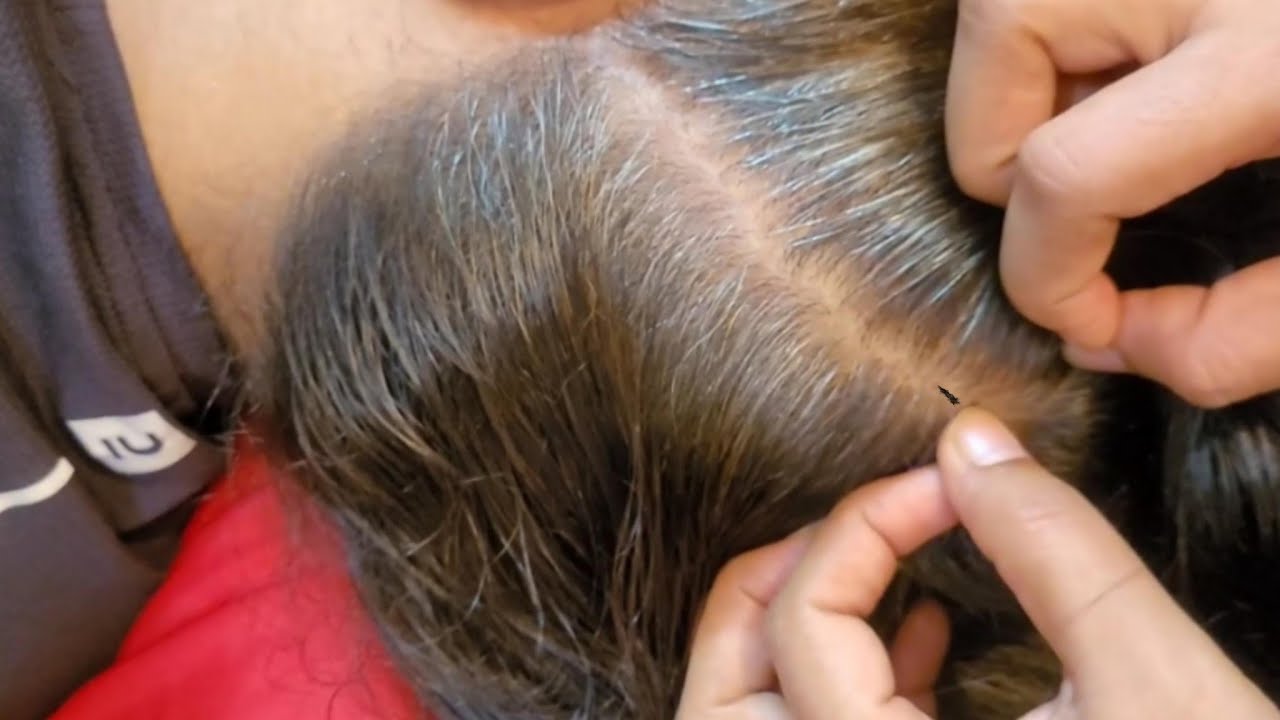 Scalp Checks That Are WAY Too Relaxing - YouTube