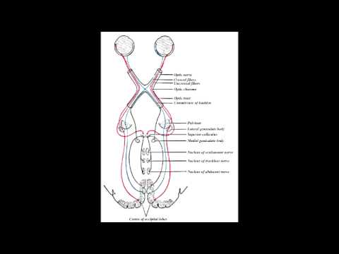 Visual Field Defects, Meyer's Loop & Dorsal Optic Radiation - YouTube