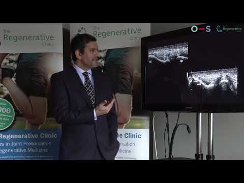 Orthopaedic surgeon Mr. Ali Noorani: the treatment of tennis elbow using injections