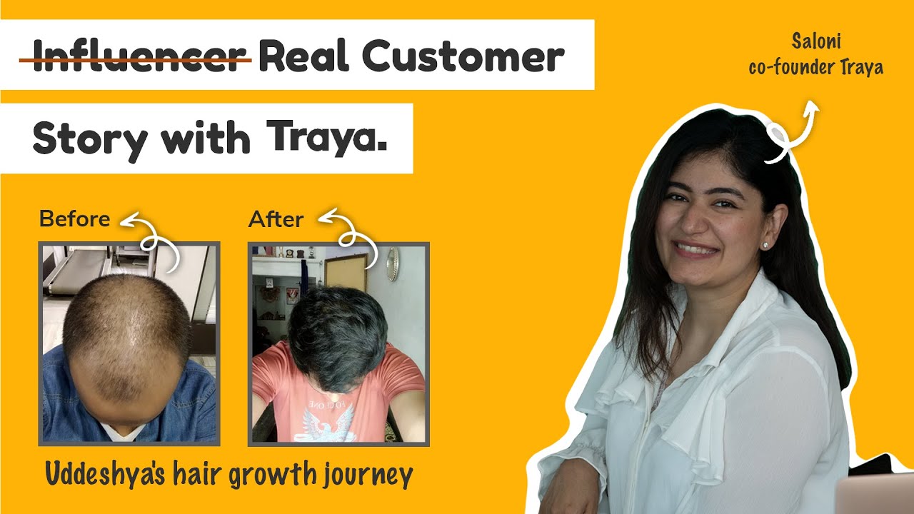 [Traya Hair Review] Traya Hair Review | How to Grow Hair in 4 Months ...