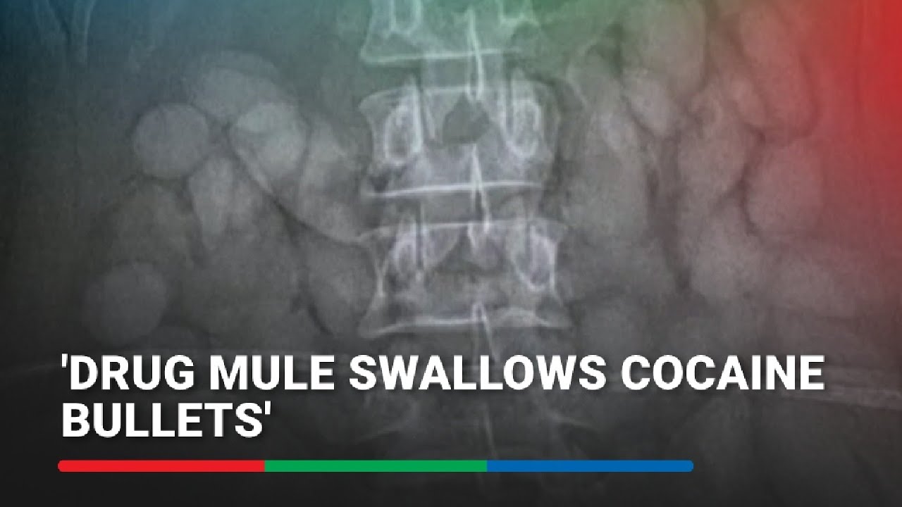 Woman caught with suspected cocaine bullets in stomach | ABS-CBN News ...