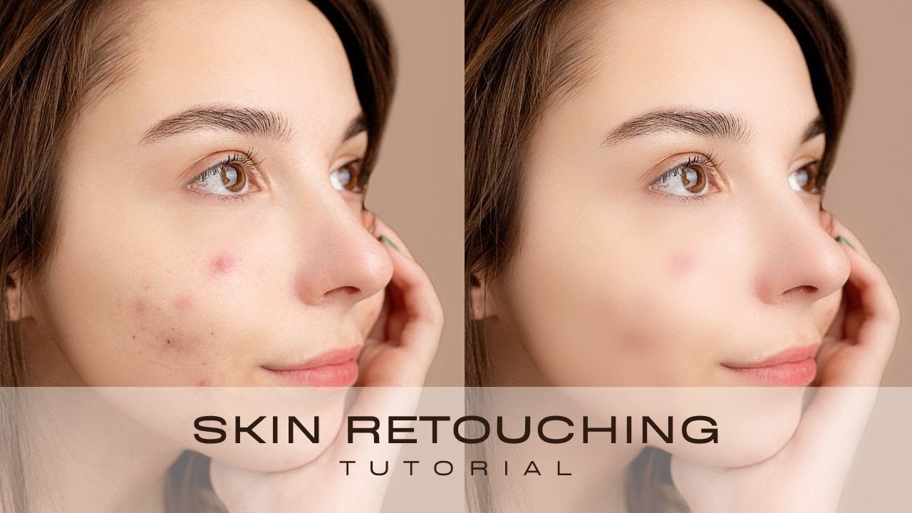 How to Quickly Smooth Skin and Remove Blemishes & Scars | Skin ...
