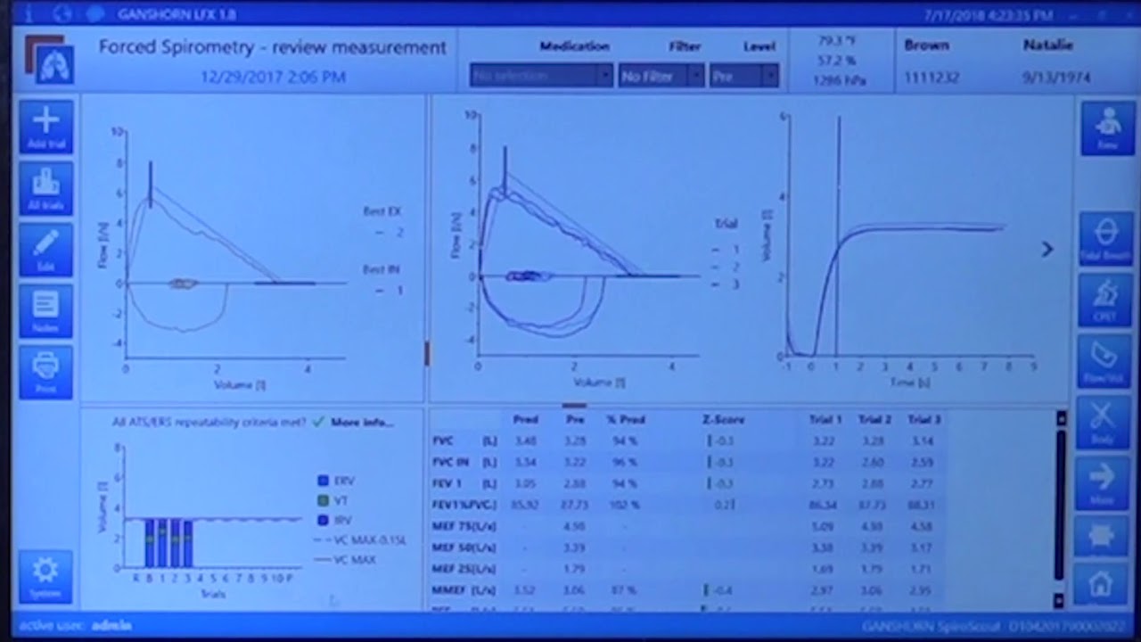 Spirometer SCHILLER Spiroscout - (Basic Usage Tutorial) #spirometer ...