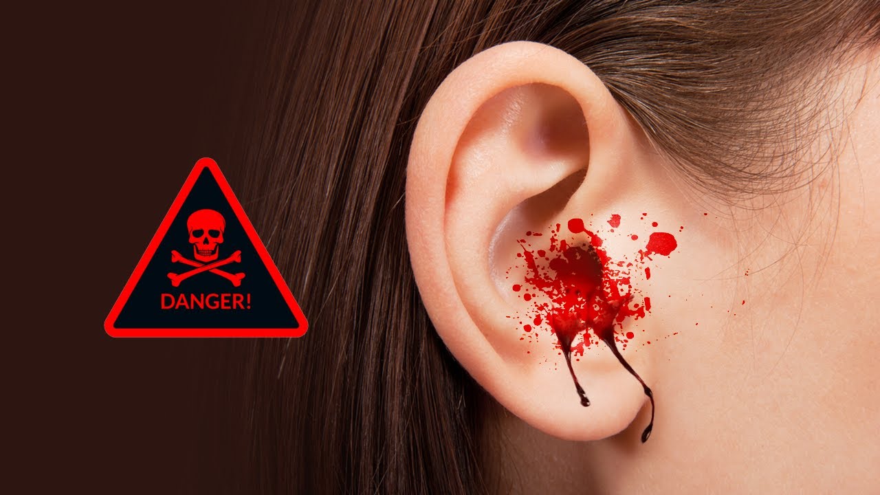 UNDERSTANDING EARACHES CAUSES AND TREATMENTS | #health #healthtips # ...