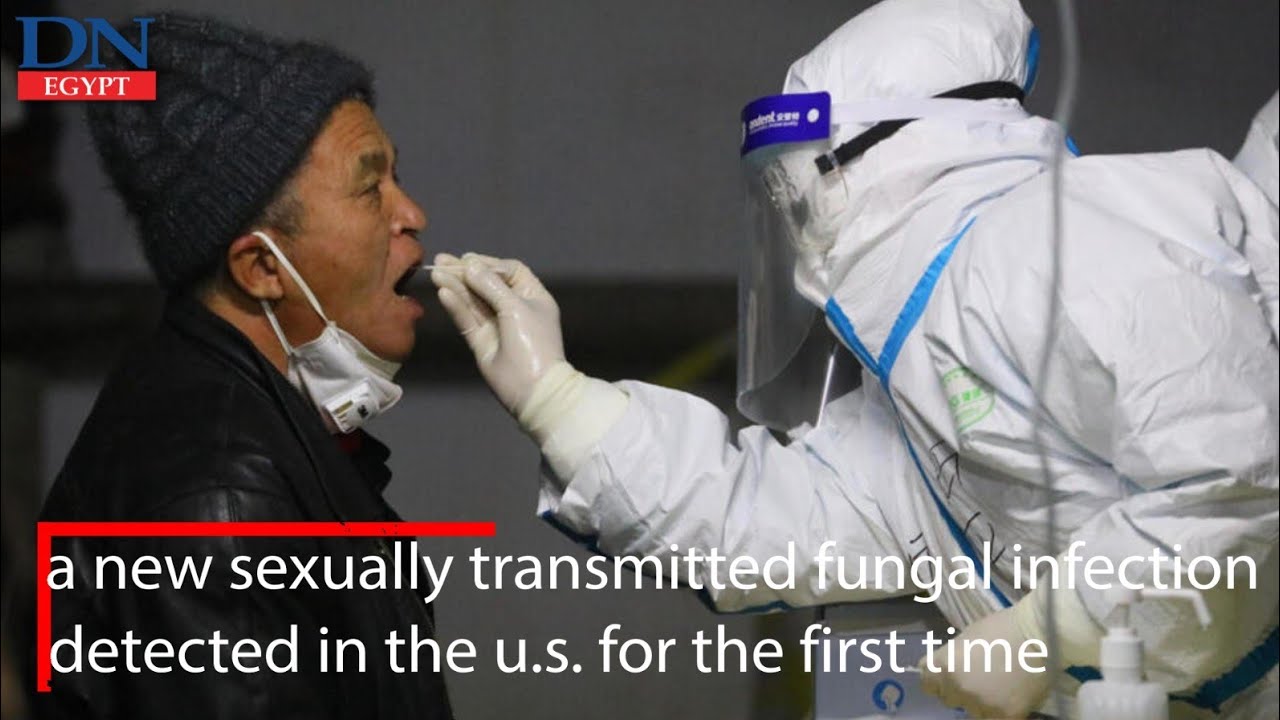 A new sexually transmitted fungal infection was detected in the U.S ...