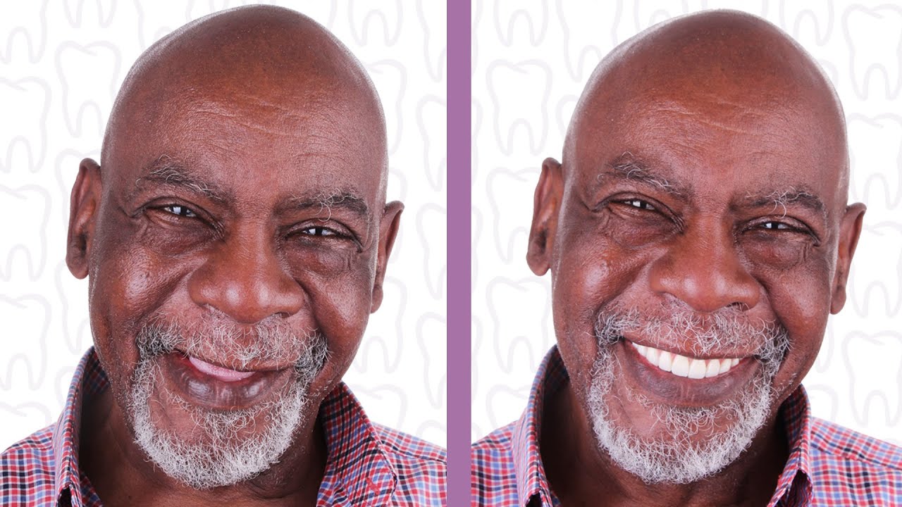 The Power of Smiling: Discovering a New You with All-on-4 in Mexico ...