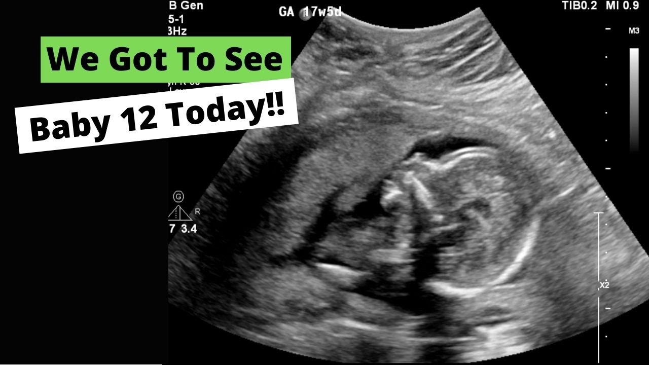 WE GOT TO SEE BABY 12 TODAY | Large Family of 13 Daily Vlog - YouTube