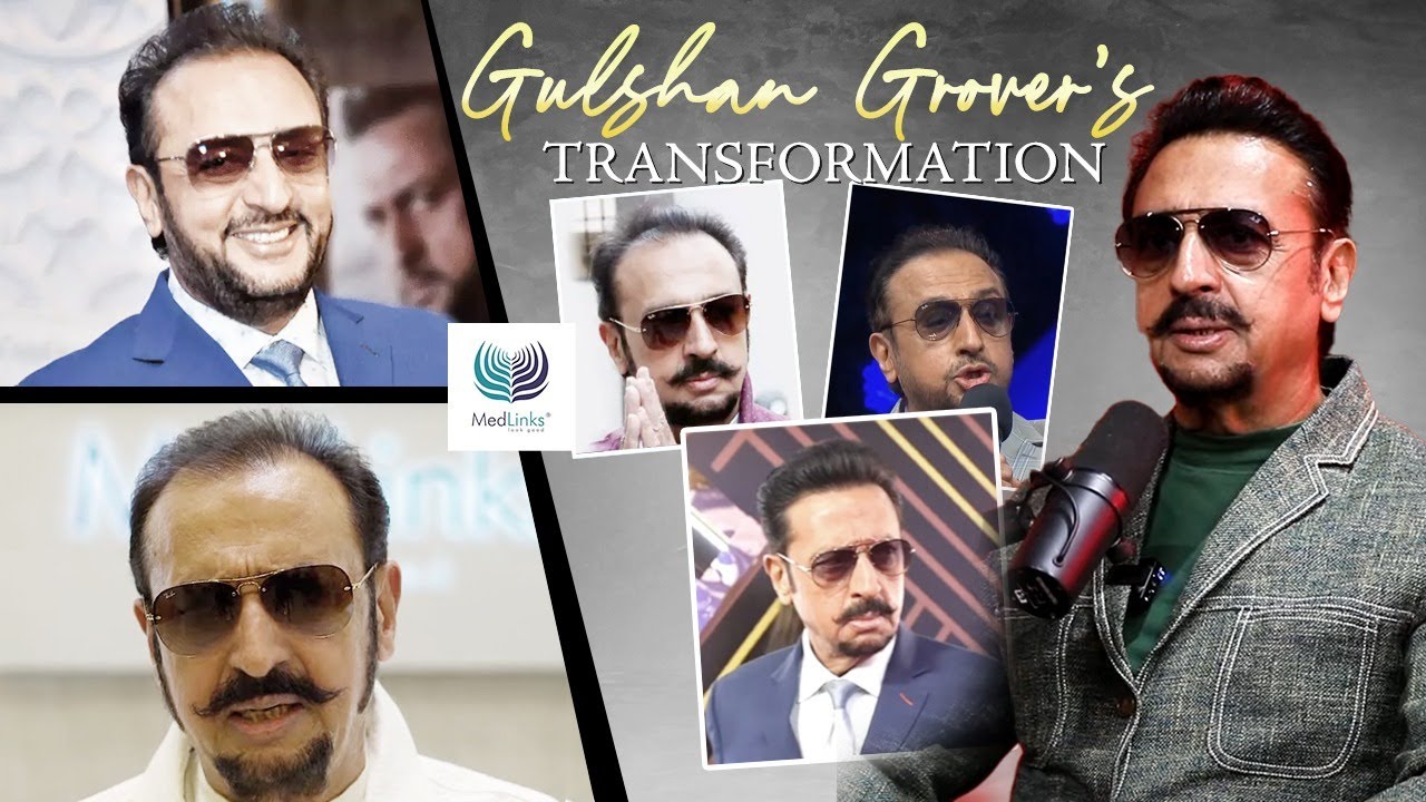 Reality of Gulshan Grover Hair Transplant | Actor Gulshan Grover New ...