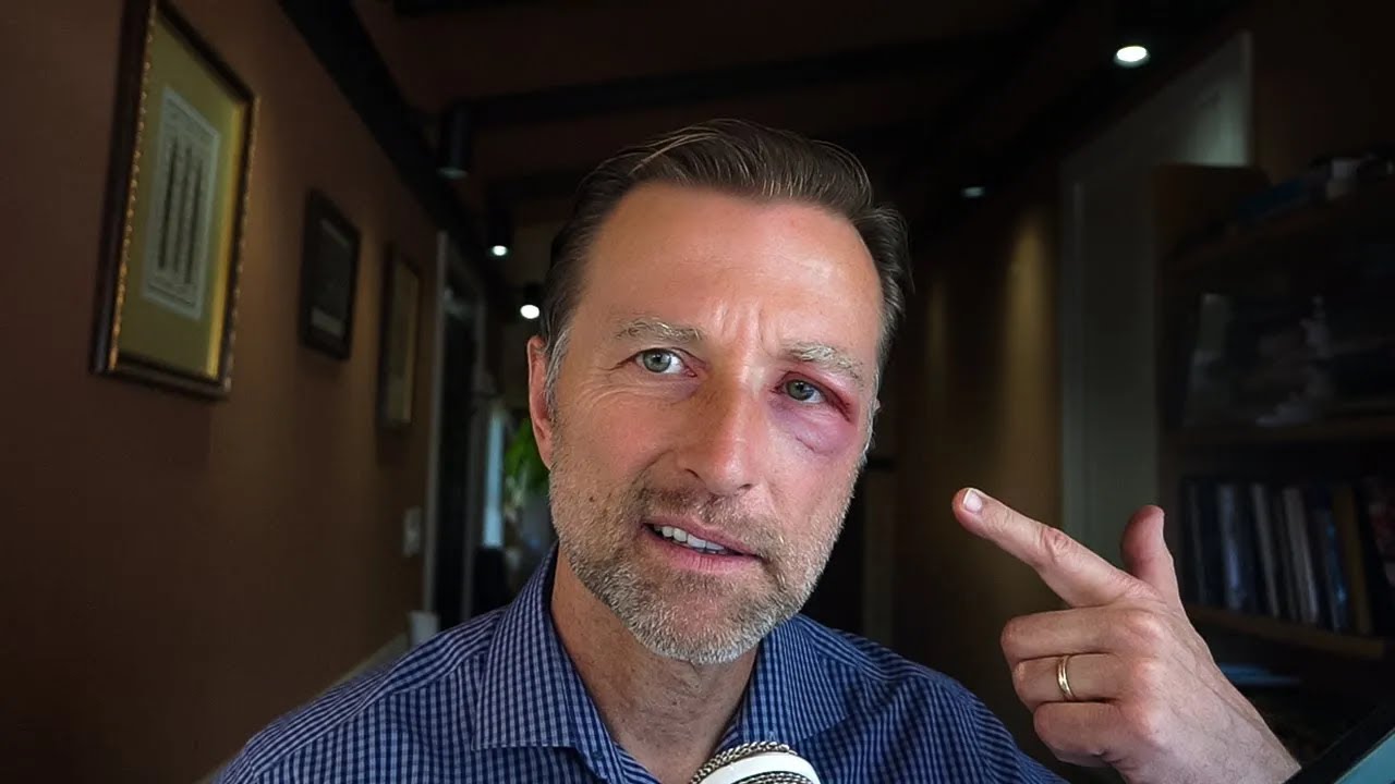 This SUCKS! - Dr. Berg - YouTube