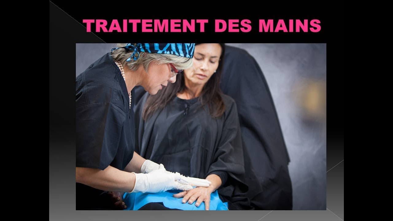 Rajeunissement des mains avec Acide Hyaluronique à la canule/ Dr Janick ...