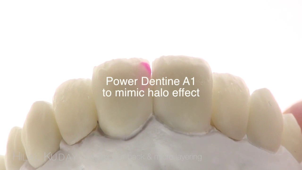 e max basic micro layering - YouTube