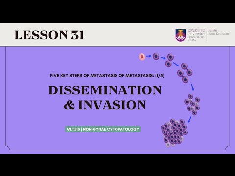 Five Key Steps of Metastasis: (1/5) Dissemination and Invasion - YouTube