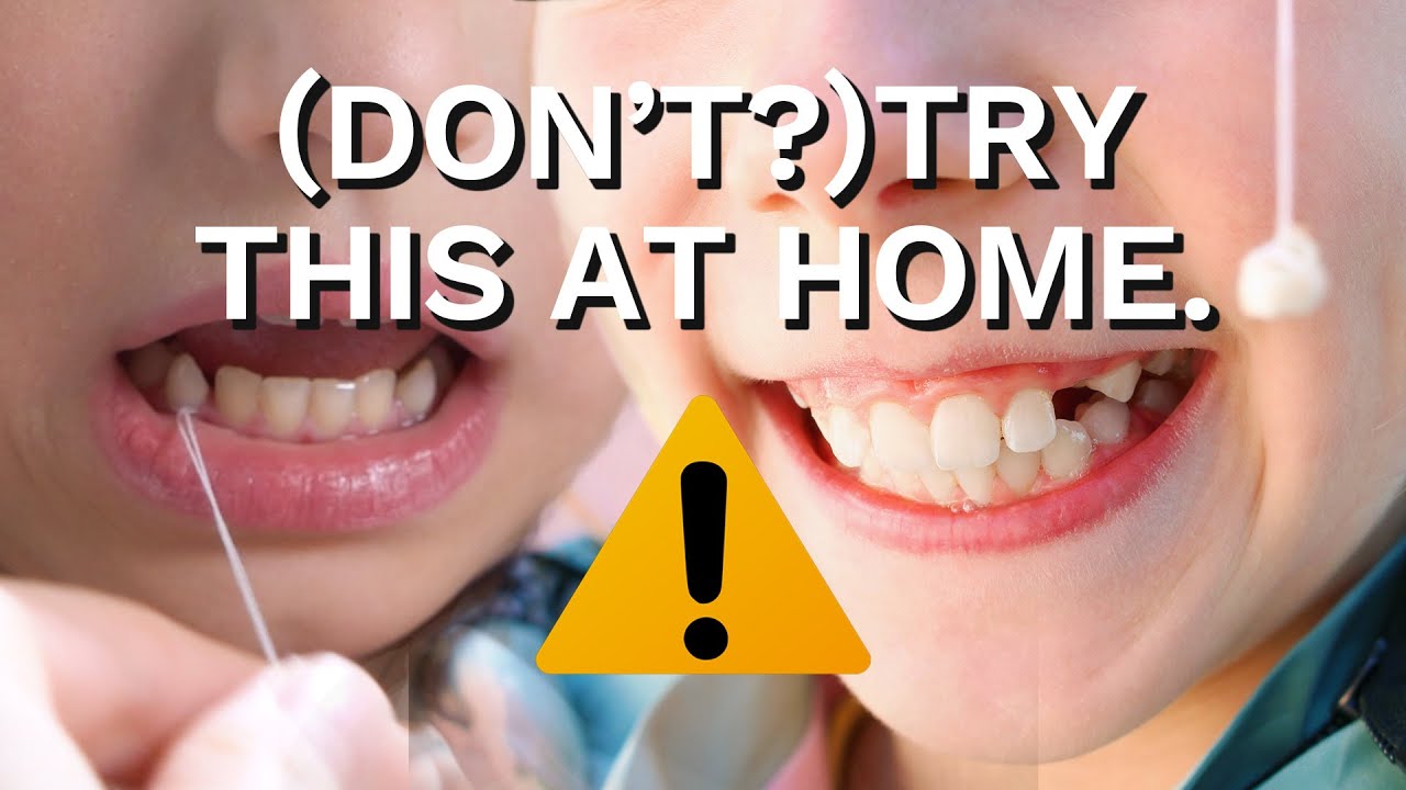 is it safe to pull out the tooth at home? - YouTube