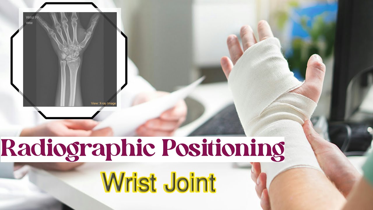 X-ray of wrist joint || Radiographic positioning || Bangla. - YouTube