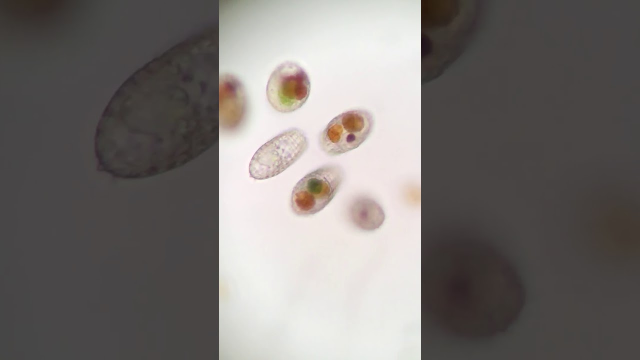 Coleps hirtus - YouTube