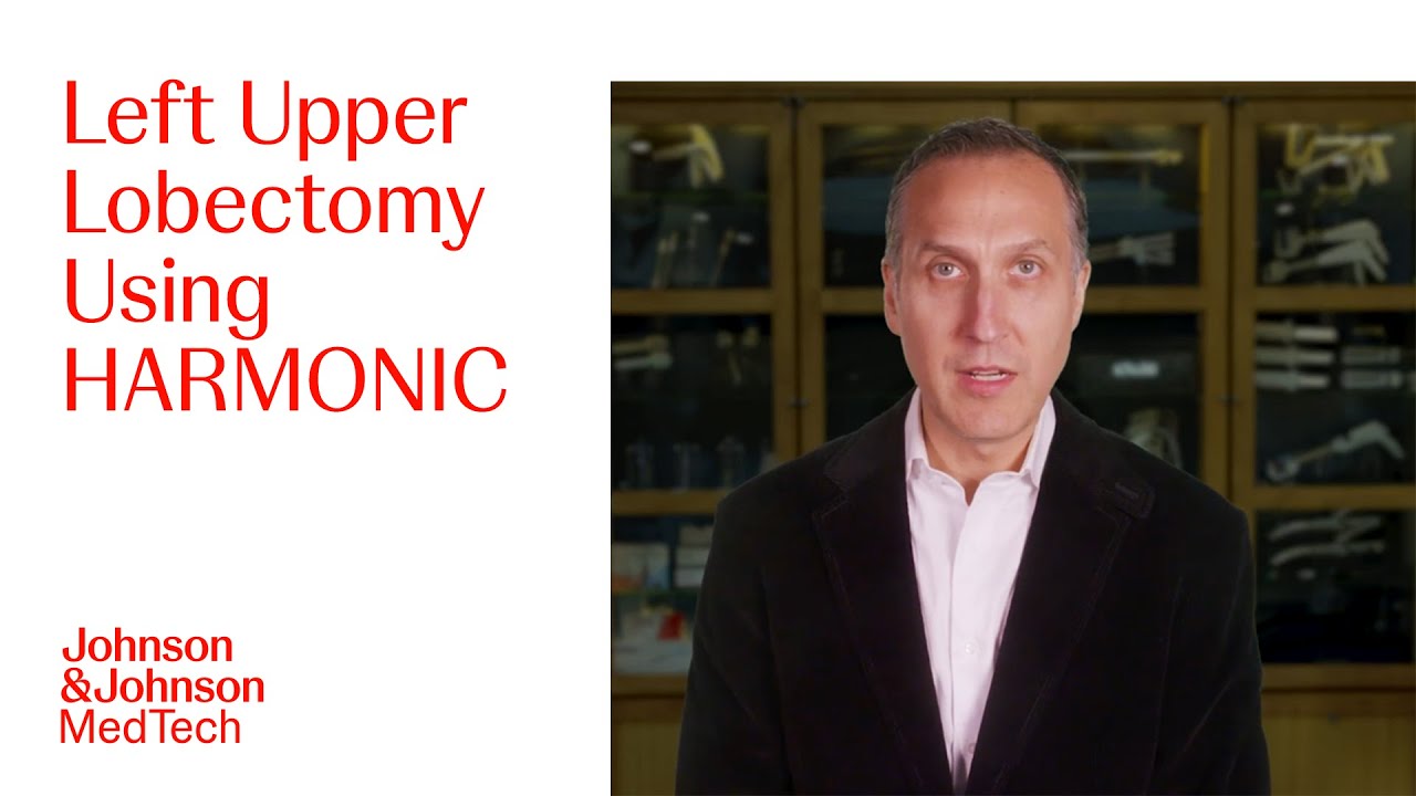 VATS Lobectomy Procedure Using HARMONIC Scalpel | J&J MedTech - YouTube