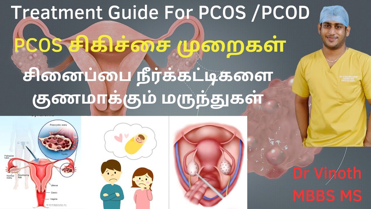 PCOS சிகிச்சை முறைகள்|PCOS treatment|How to reverse PCOS|PCOS permanent ...